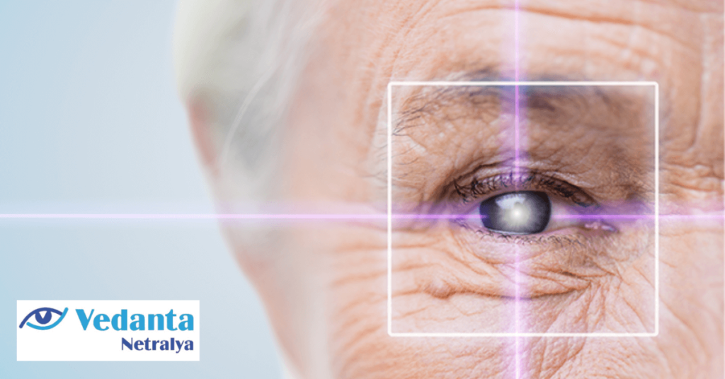 Cataract Surgery with Glaucoma: Is It Safe? - Vedanta Netralya